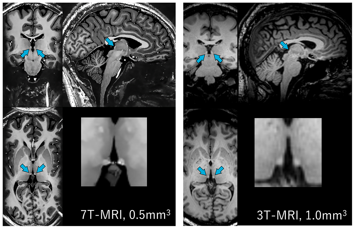 Human Brain Research Center (HBRC) - Human Brain Research Center