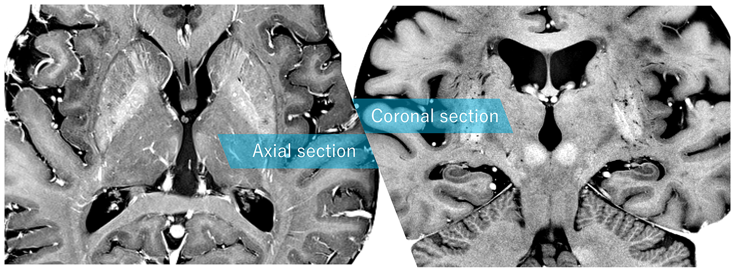 Human Brain Research Center (HBRC) - Human Brain Research Center