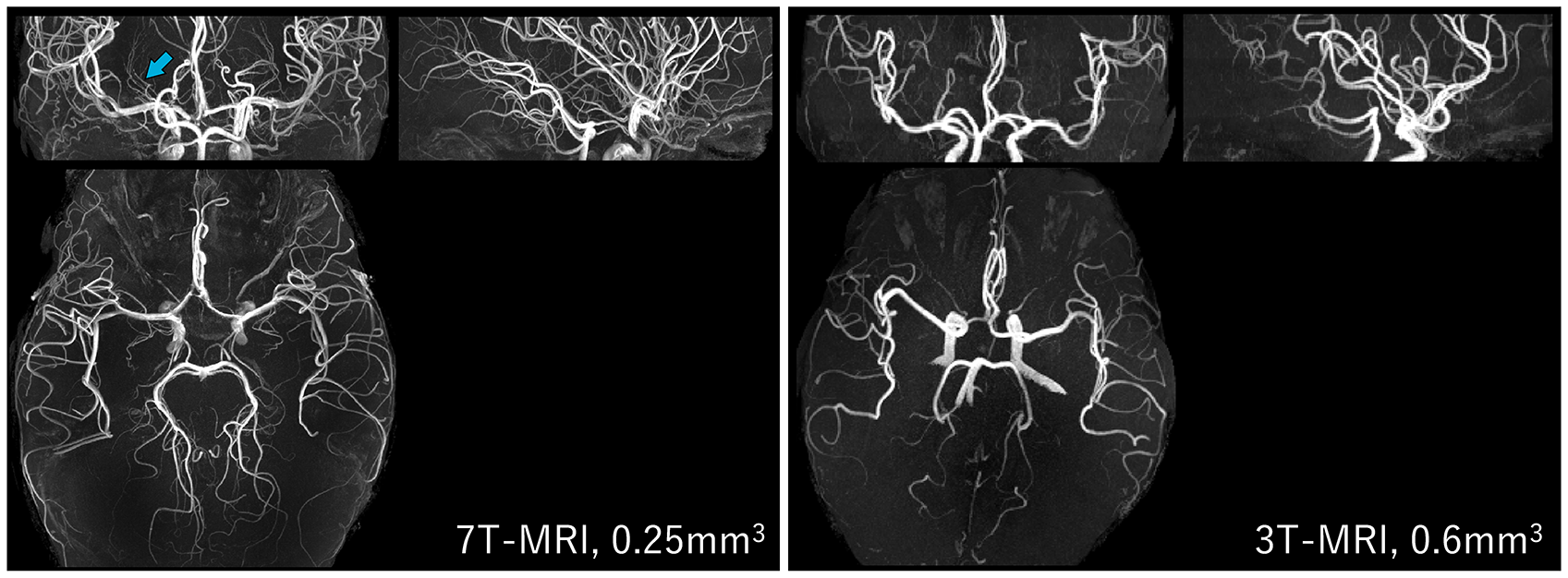 Human Brain Research Center (HBRC) - Human Brain Research Center