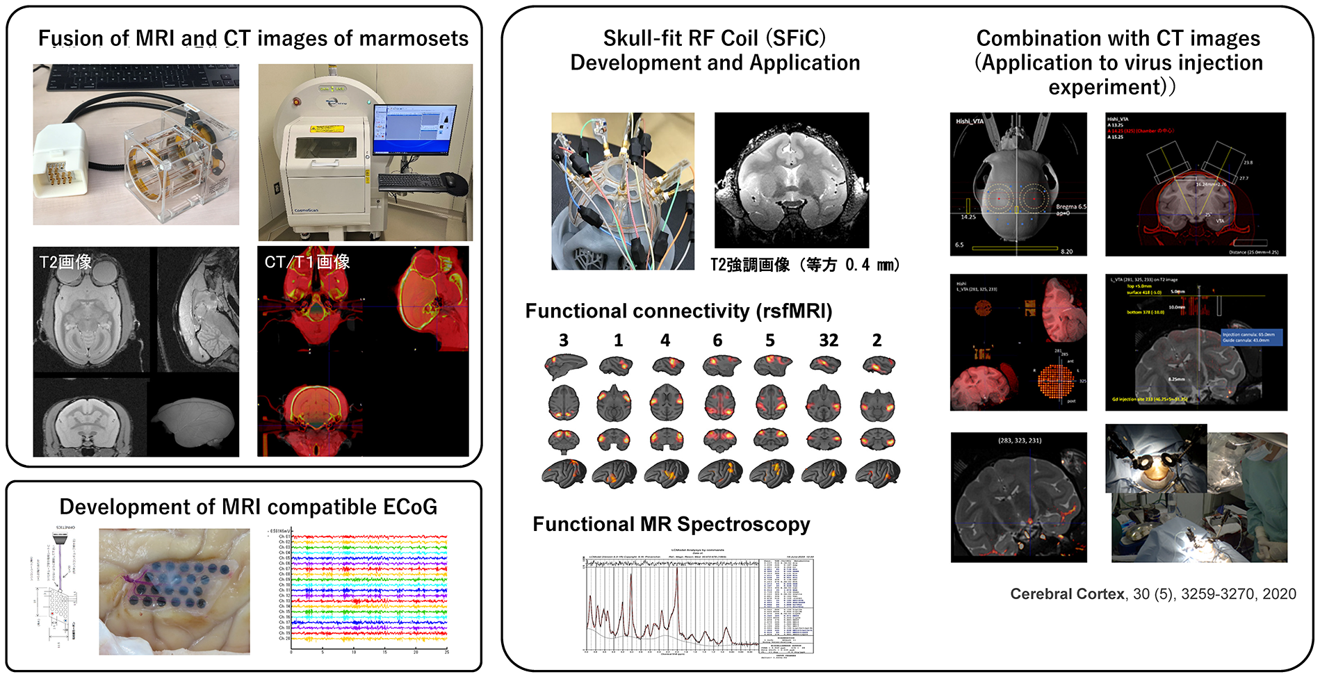 Human Brain Research Center (HBRC) - Human Brain Research Center